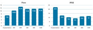 Treatment of BPH - iTind - Prostate Matters