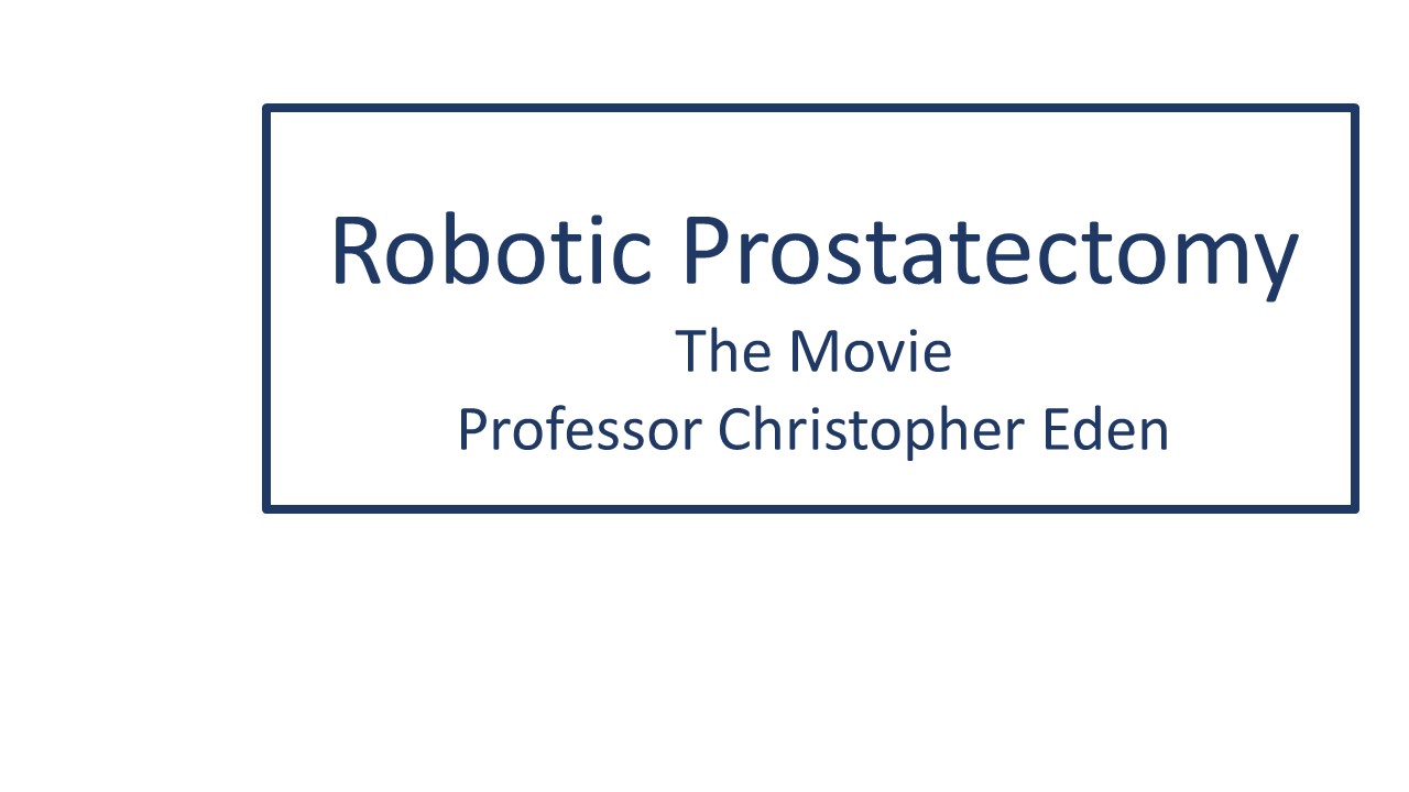 Where to access robotic prostatectomy - Prostate Matters