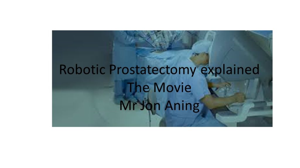 Where to access robotic prostatectomy - Prostate Matters